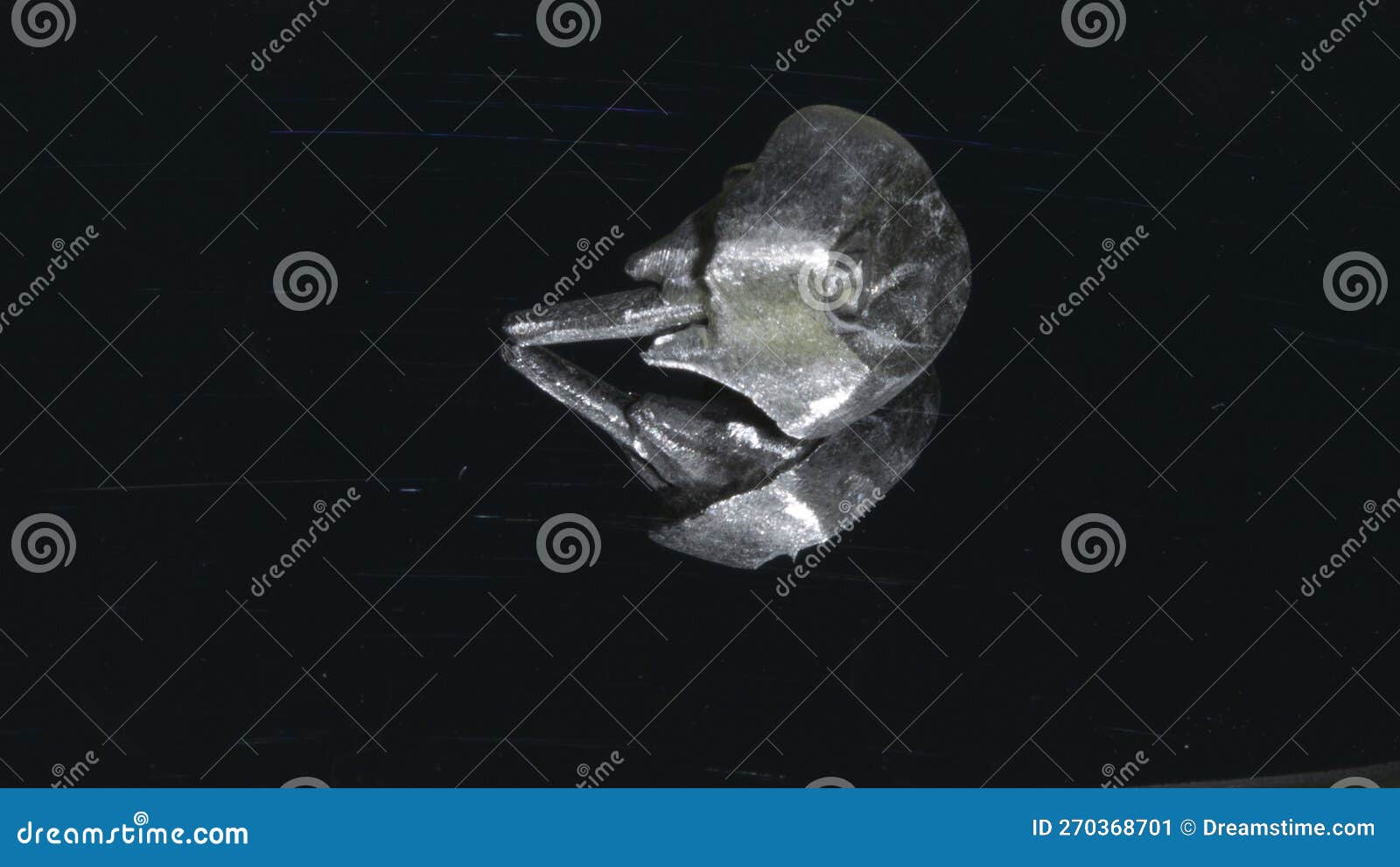 Metallic Post and Core Build-up for Molar Stock Image - Image of chrome ...