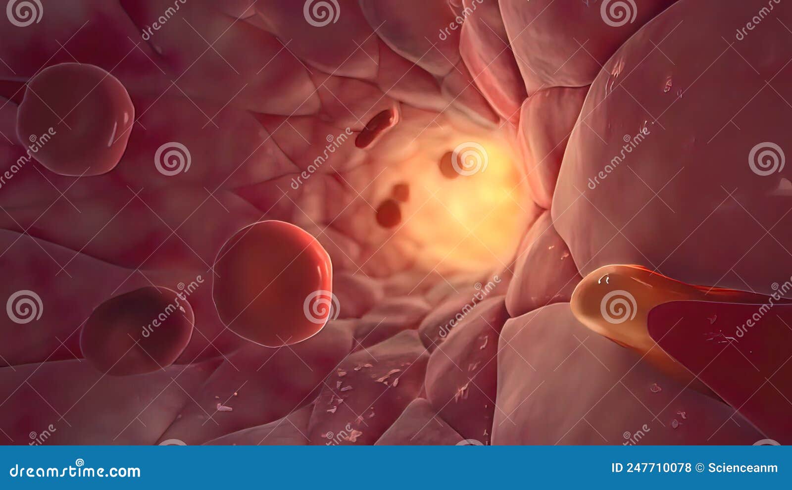 Metastasis for Cancer that Spreads To a Different Part of the Body from ... Metastasis for Cancer that Spreads To a Different Part of the Body from ...