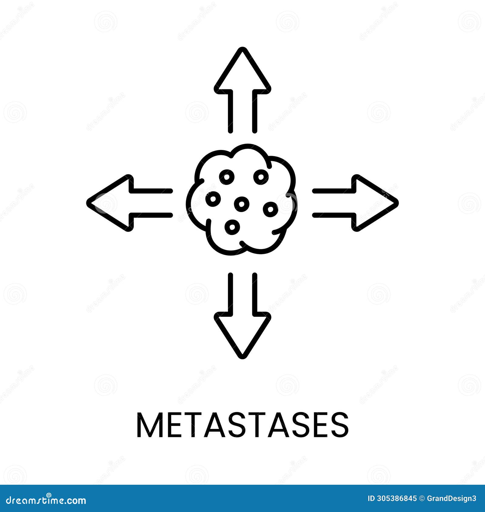 Metastasis. Cancer Invasion. Malignant Tumor Cartoon Vector ...