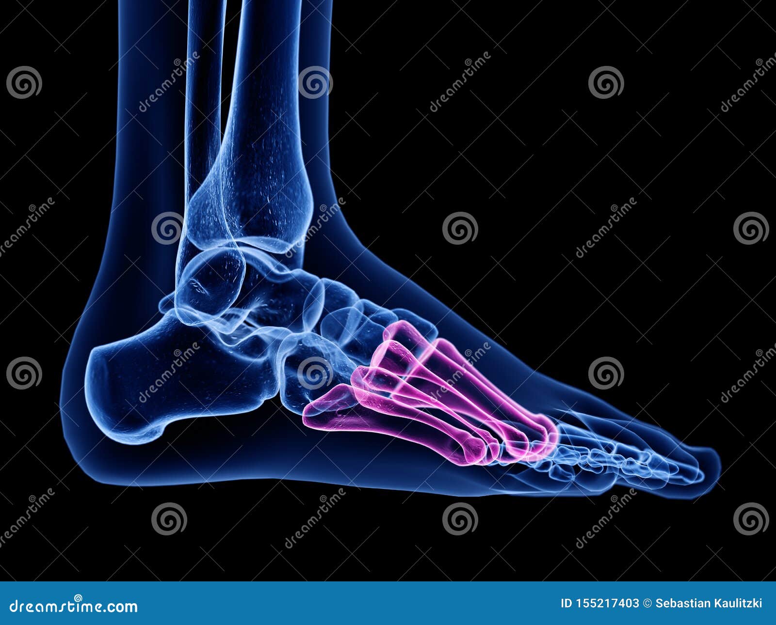 The metatarsal bone stock illustration. Illustration of anatomical ...