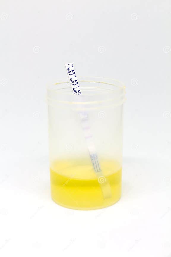 Methamphetamine test stock photo. Image of methamphetamine - 73406530