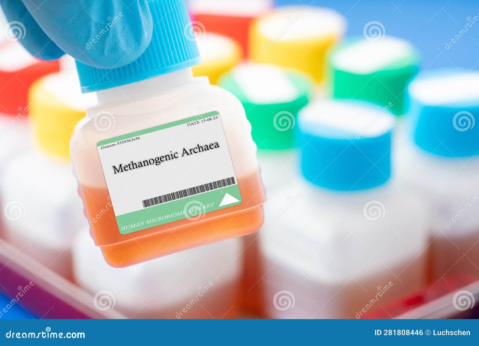 Methanogenic Archaea stock photo. Image of biology, body - 281808446