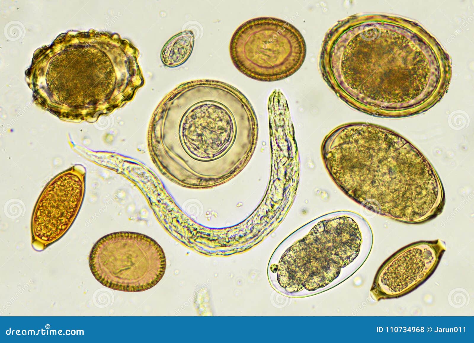 Mezclado De Helmintos En Taburete Foto de archivo - Imagen de prueba ...