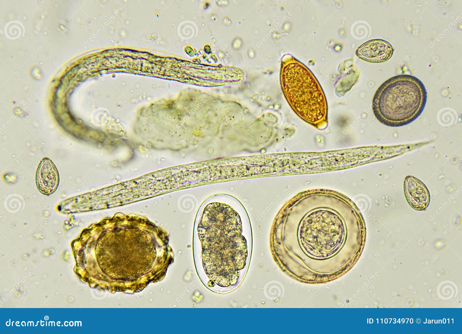 Mezclado De Helmintos En Taburete Foto de archivo - Imagen de protozoos ...