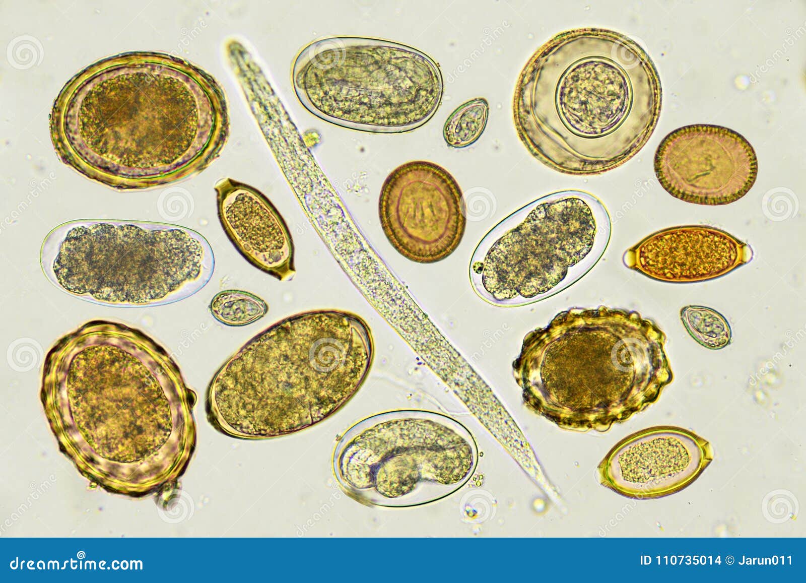 Mezclado De Helmintos En Taburete Foto de archivo - Imagen de platija ...