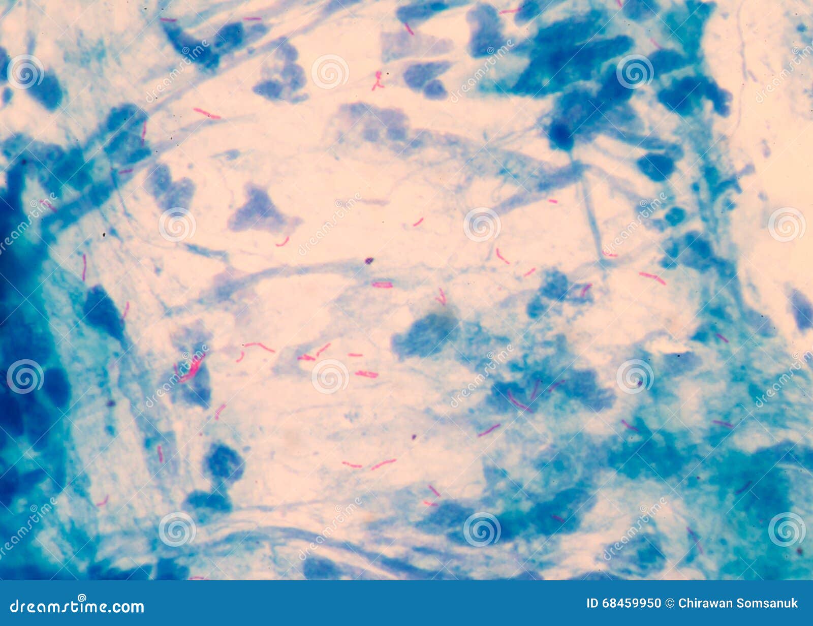 Micro Bacterium Tuberculosis. Stock Photo - Image of blue, micro: 68459950