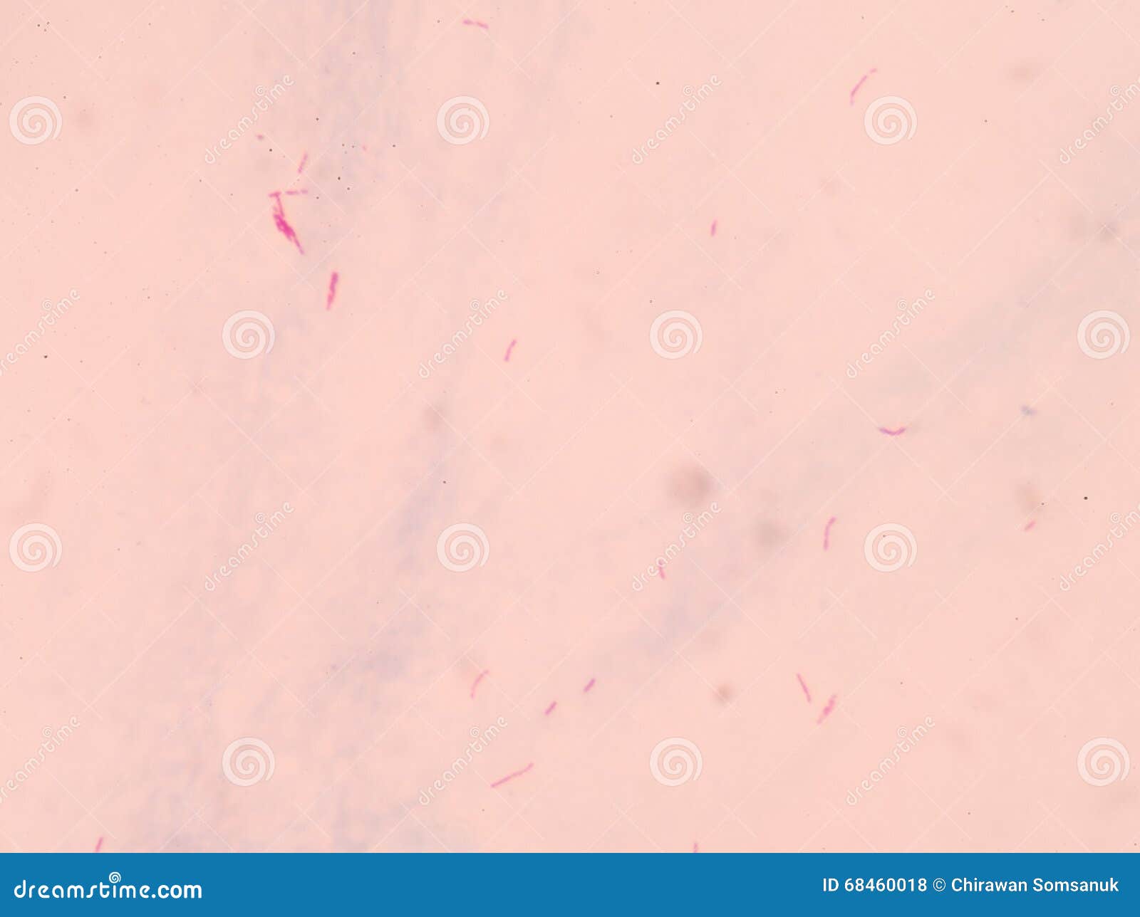 Micro Bacterium Tuberculosis. Stock Photo - Image of bacteria ...