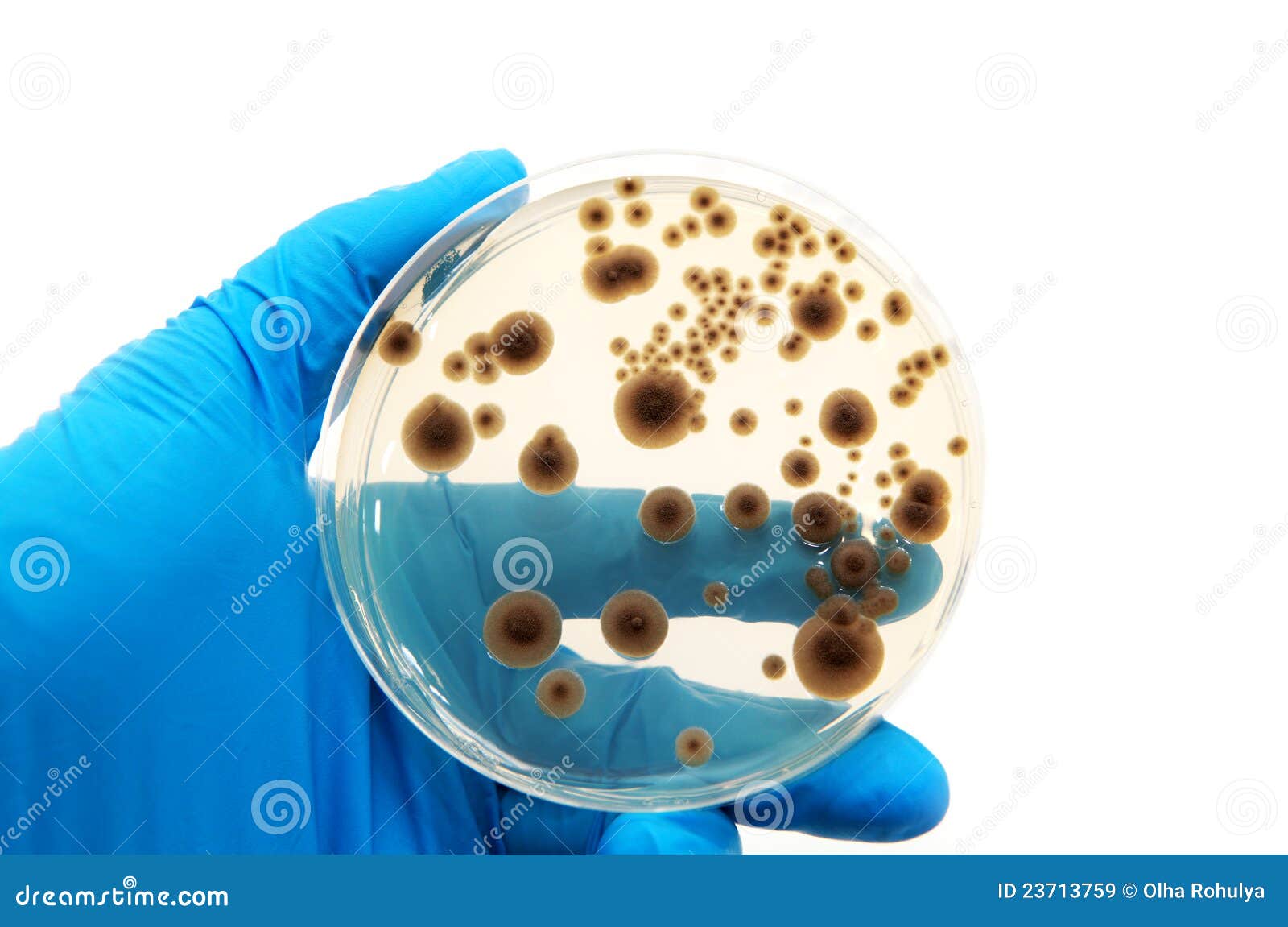 Micro Agar How To Make Skim Milk Agar Plates