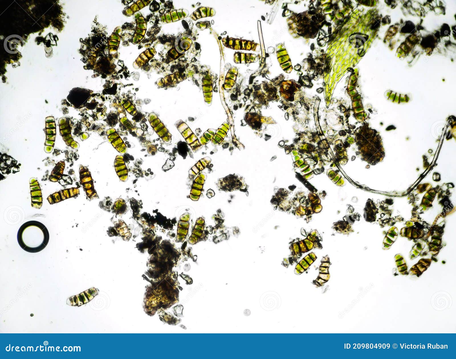 Microalgae Under a Microscope Stock Image - Image of phytoplankton ...