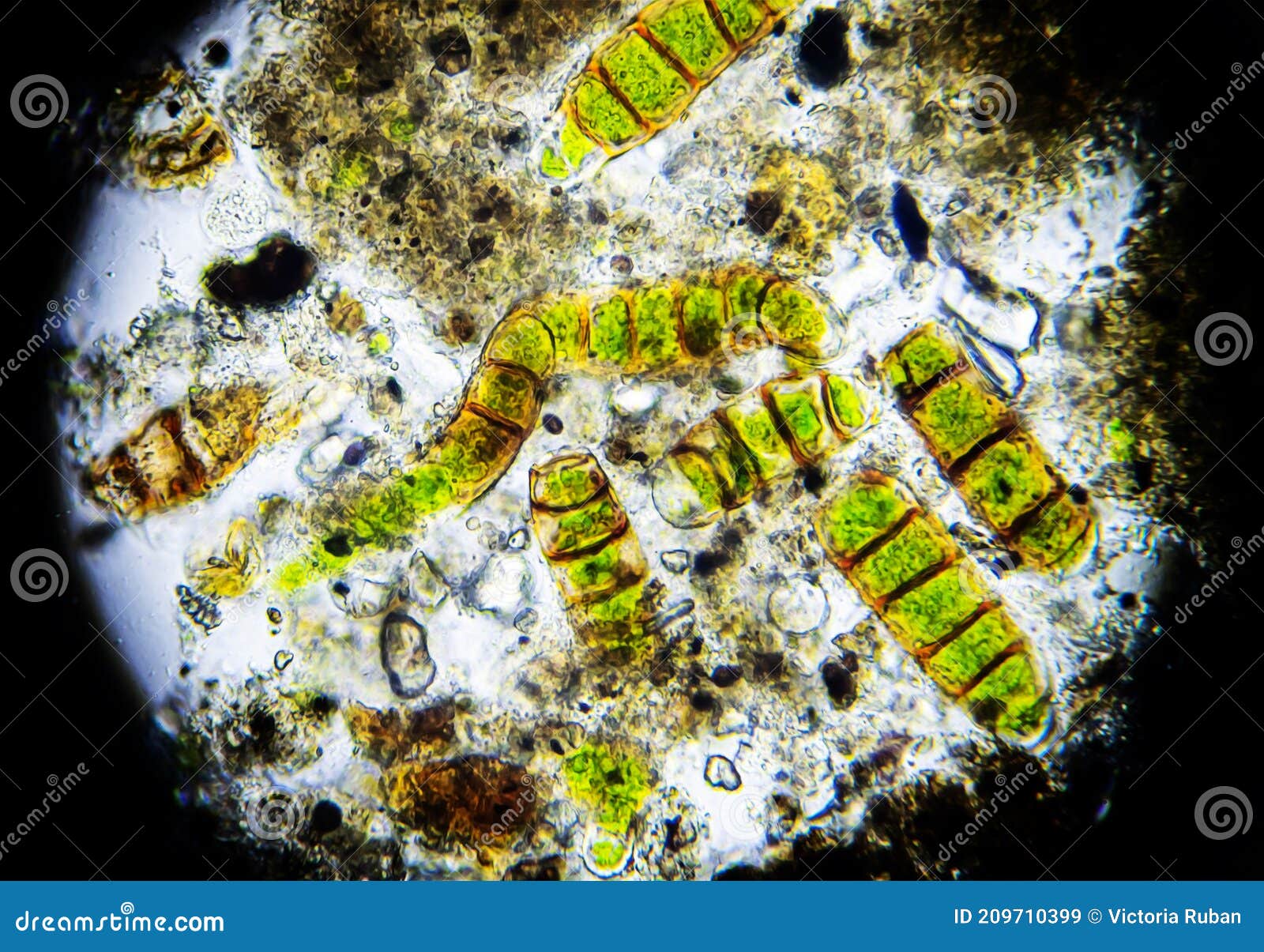 Microalgae Under Microscopic View, Green Algae, Cyanobacteria ...