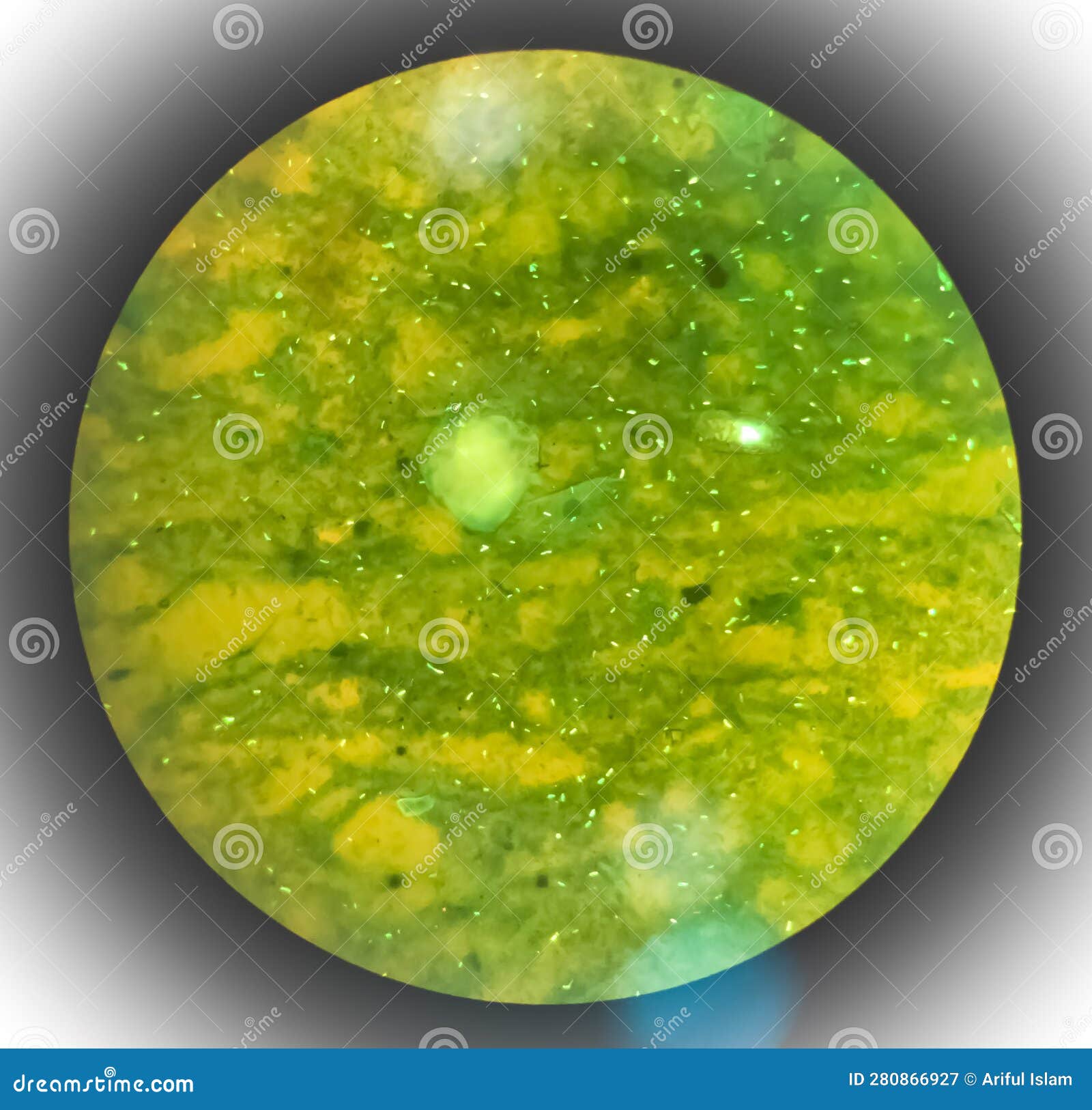 Microbacterium Tuberculosis Bacteria (MTB). Stock Image - Image of ...