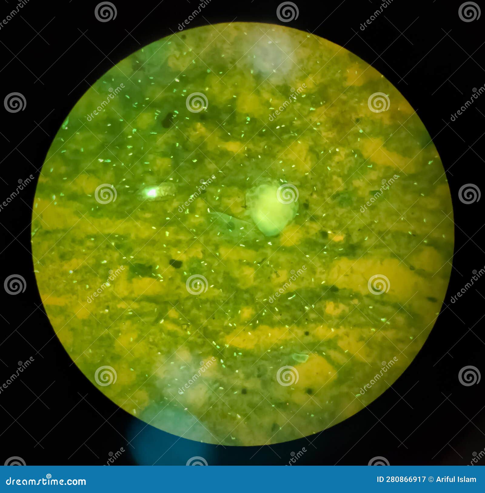 Microbacterium Tuberculosis Bacteria (MTB). Royalty-Free Stock Photo ...
