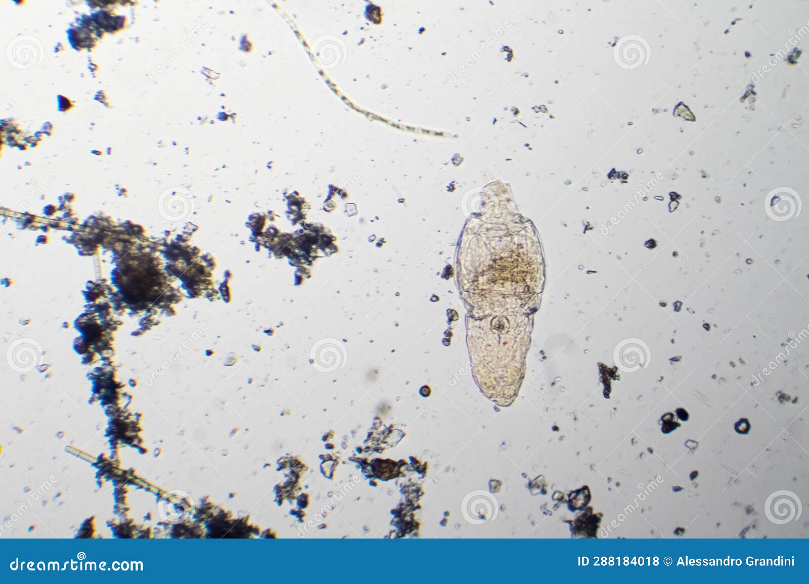 Rotifer Under The Microscope . Royalty-Free Stock Photography ...
