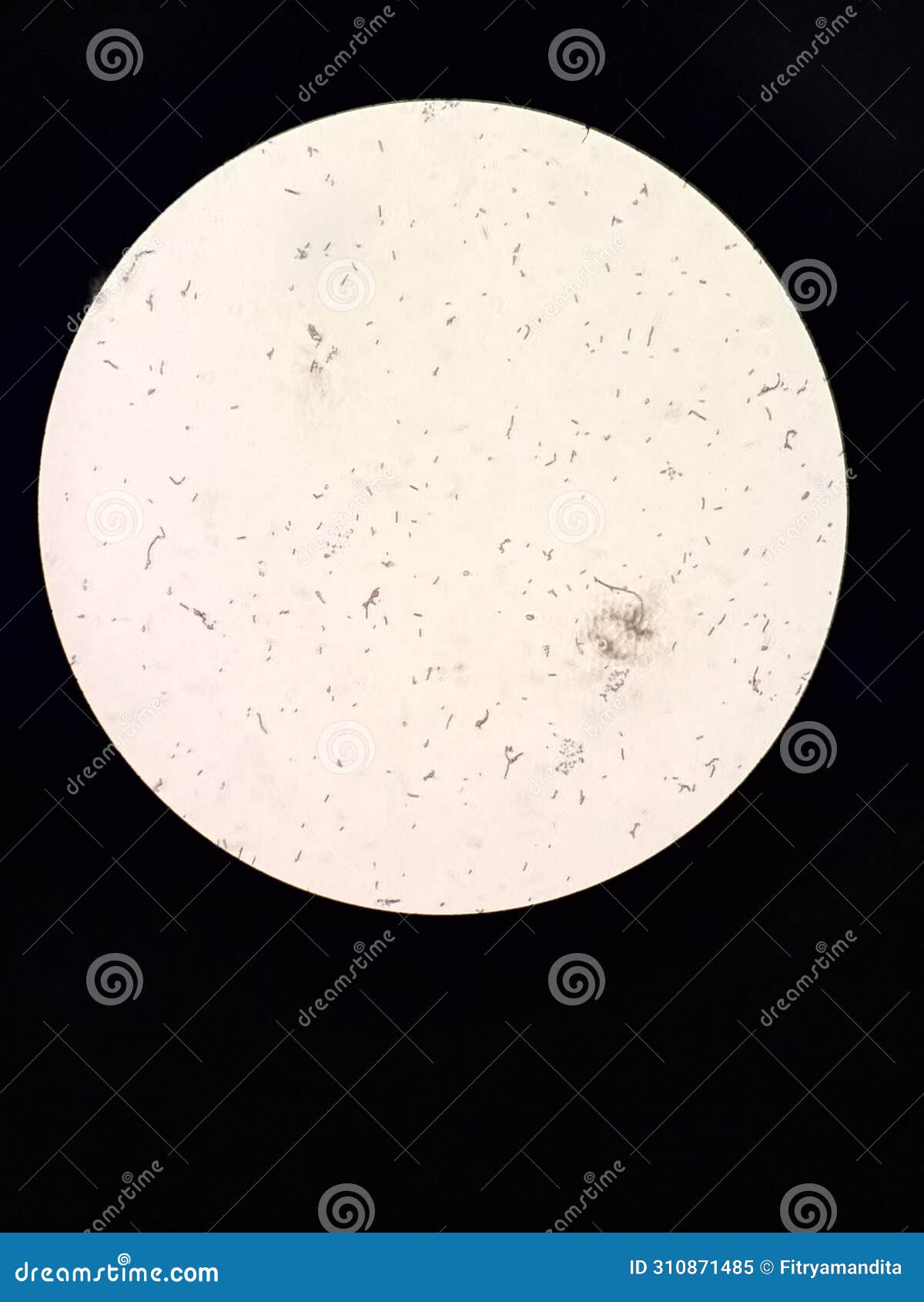 Microbes Under the Microscope Stock Image - Image of microscope ...