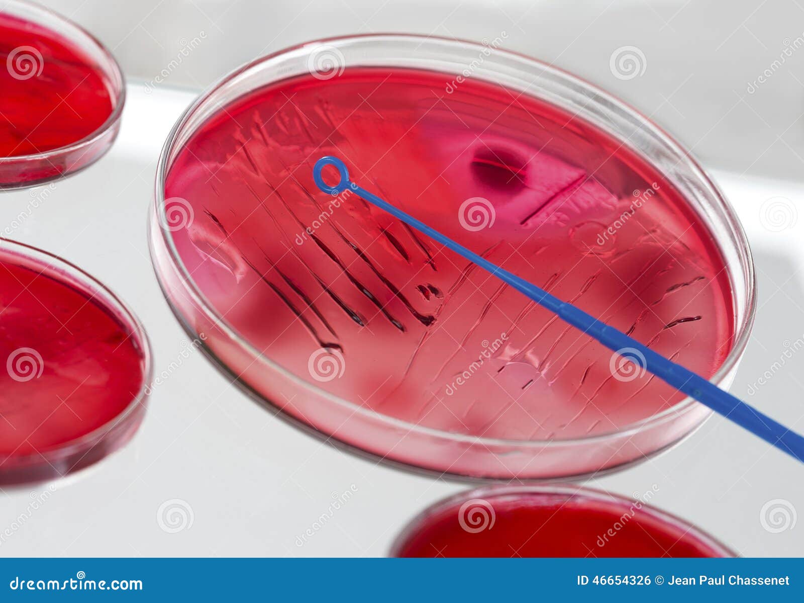 MICROBIOLOGÍA DE LA INOCULACIÓN Foto de archivo - Imagen de petri ...