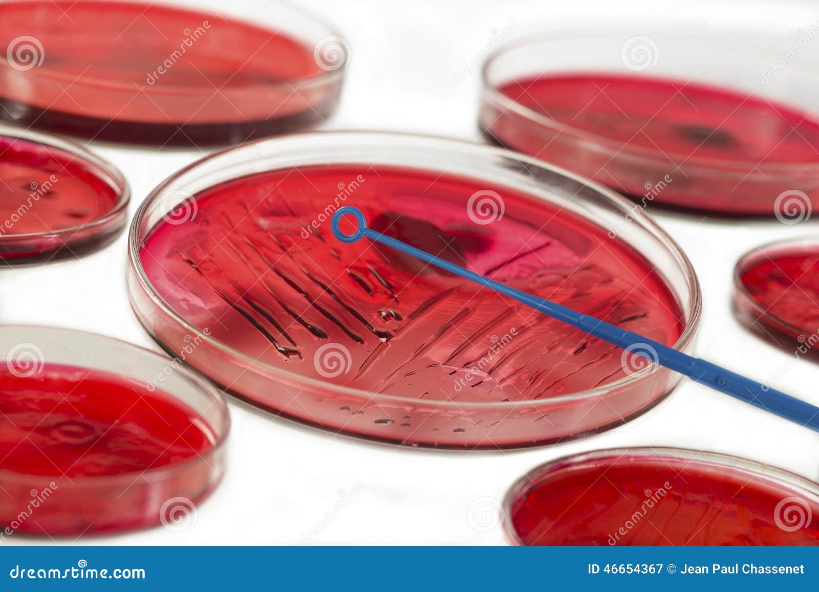 MICROBIOLOGÍA DE LA INOCULACIÓN Imagen de archivo - Imagen de vida ...