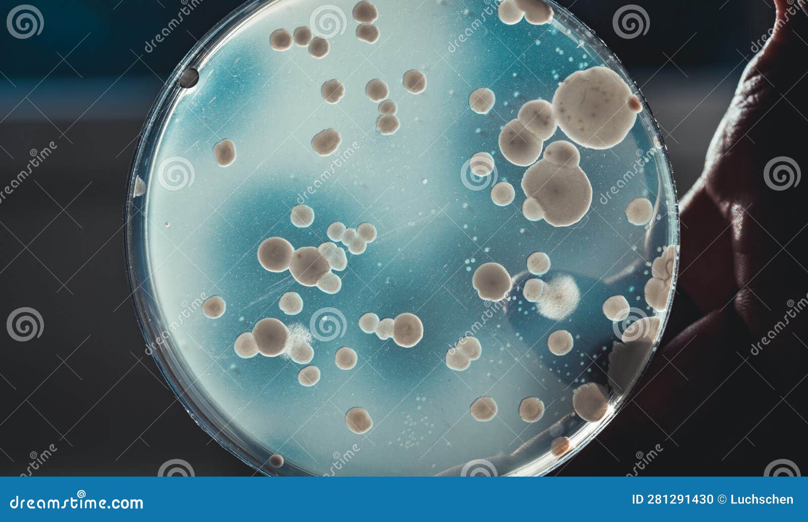 Microbiological Analysis of Agricultural Soil Stock Photo - Image of ...