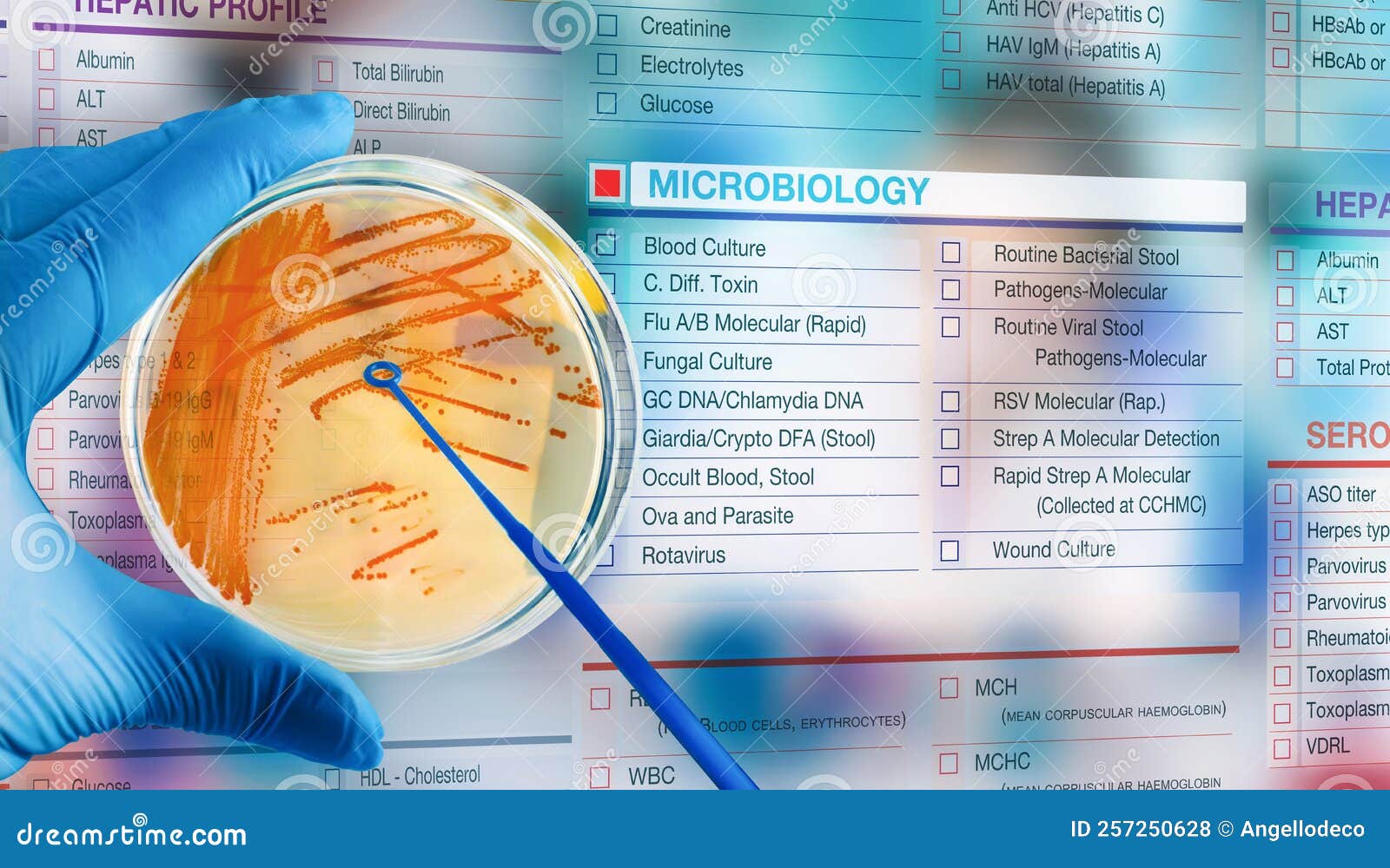 Microbiologist Holding Petri Dish with Streptococcus Agalactiae ...
