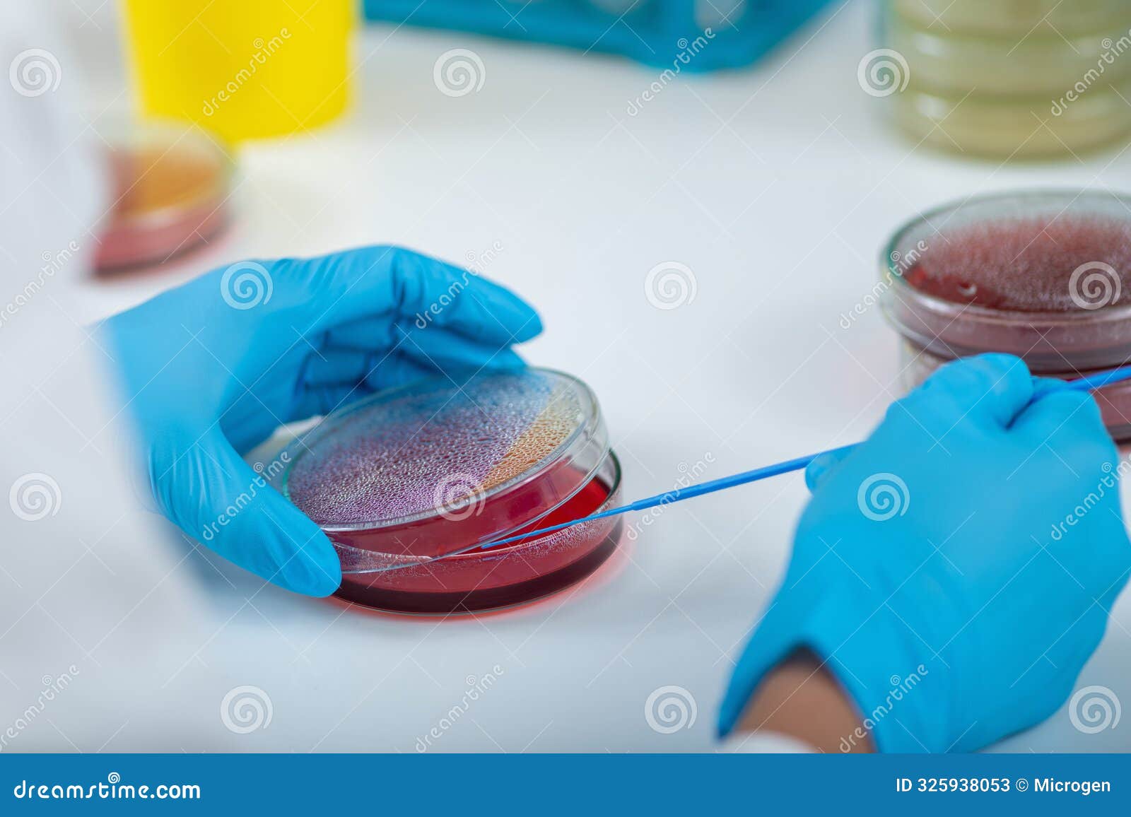Microbiologist Inoculating Blood Agar in Petri Dish in Research Lab ...