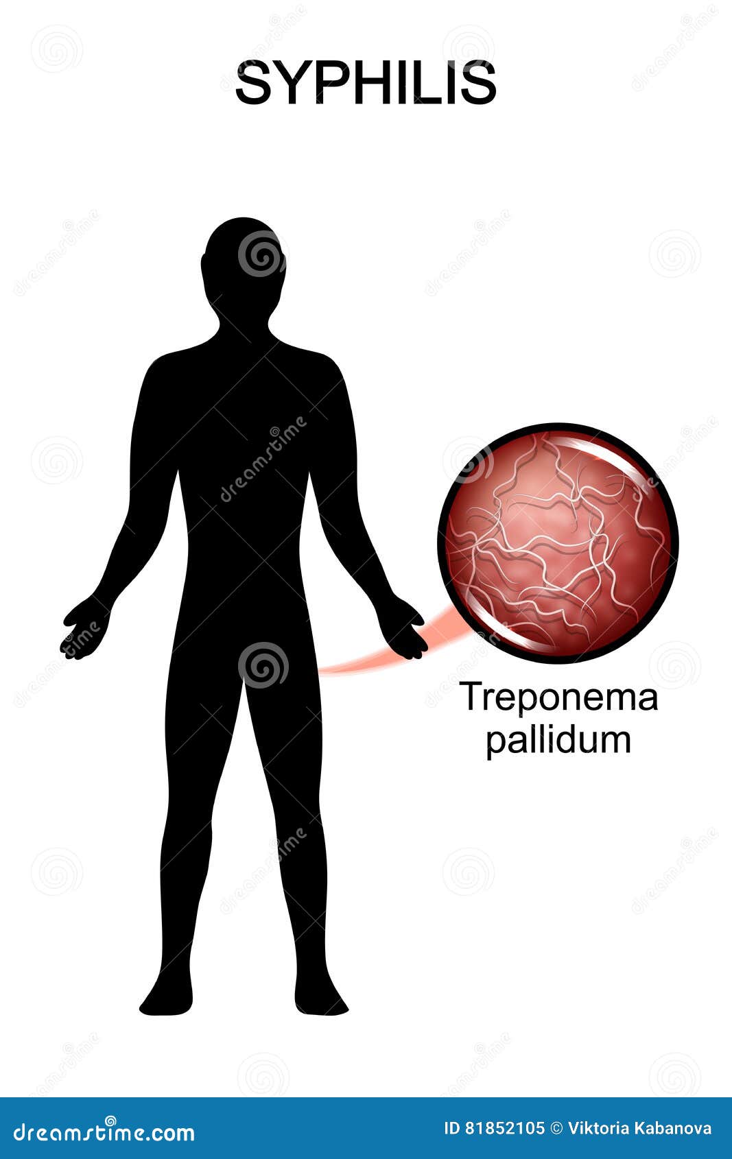 Microbiology De Causatieve Agent Van Syfilis Vector Illustratie ...