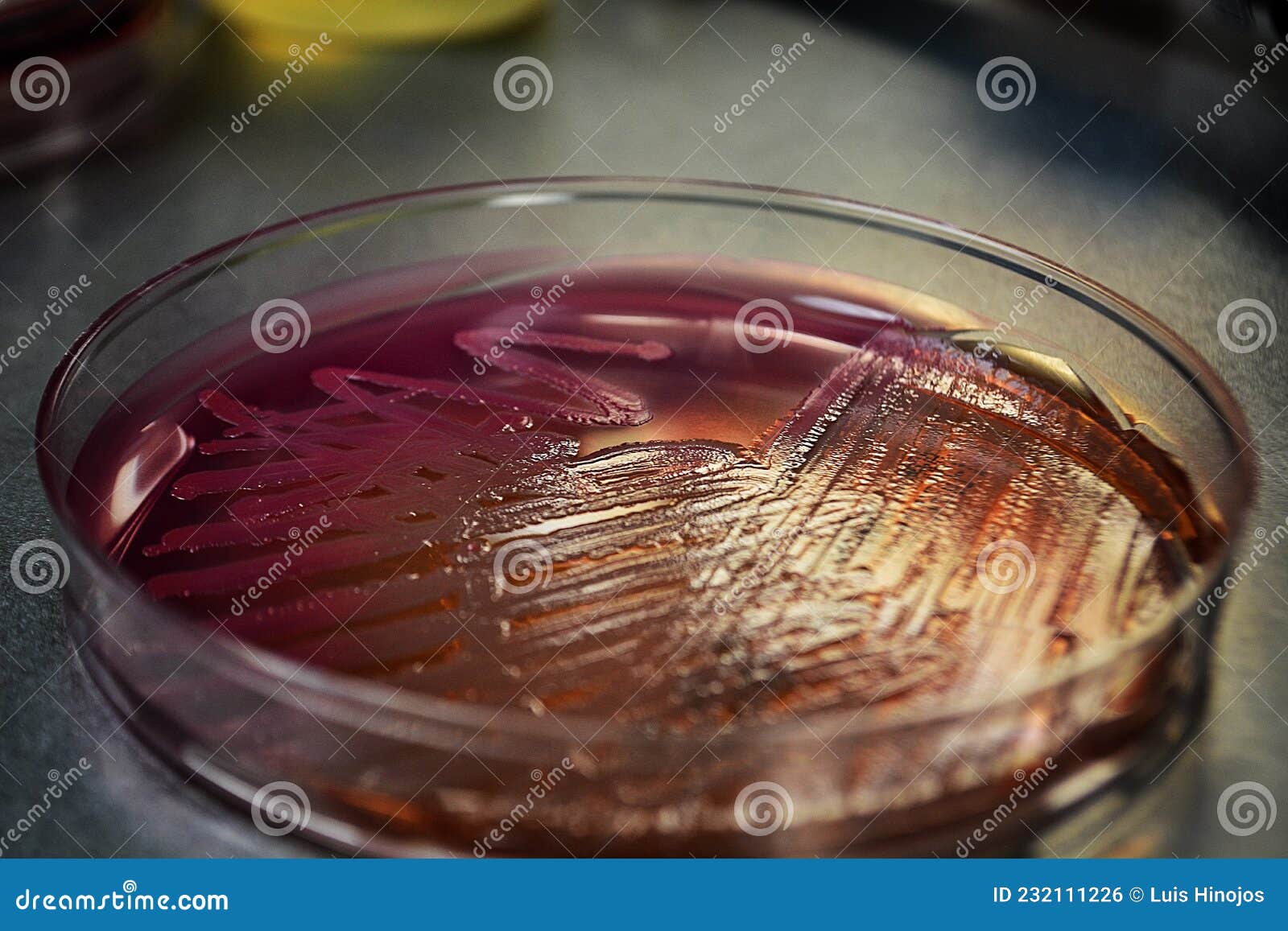 Microbiology Escherichia Coli Colonie in Macconkey Agar Stock Photo ...