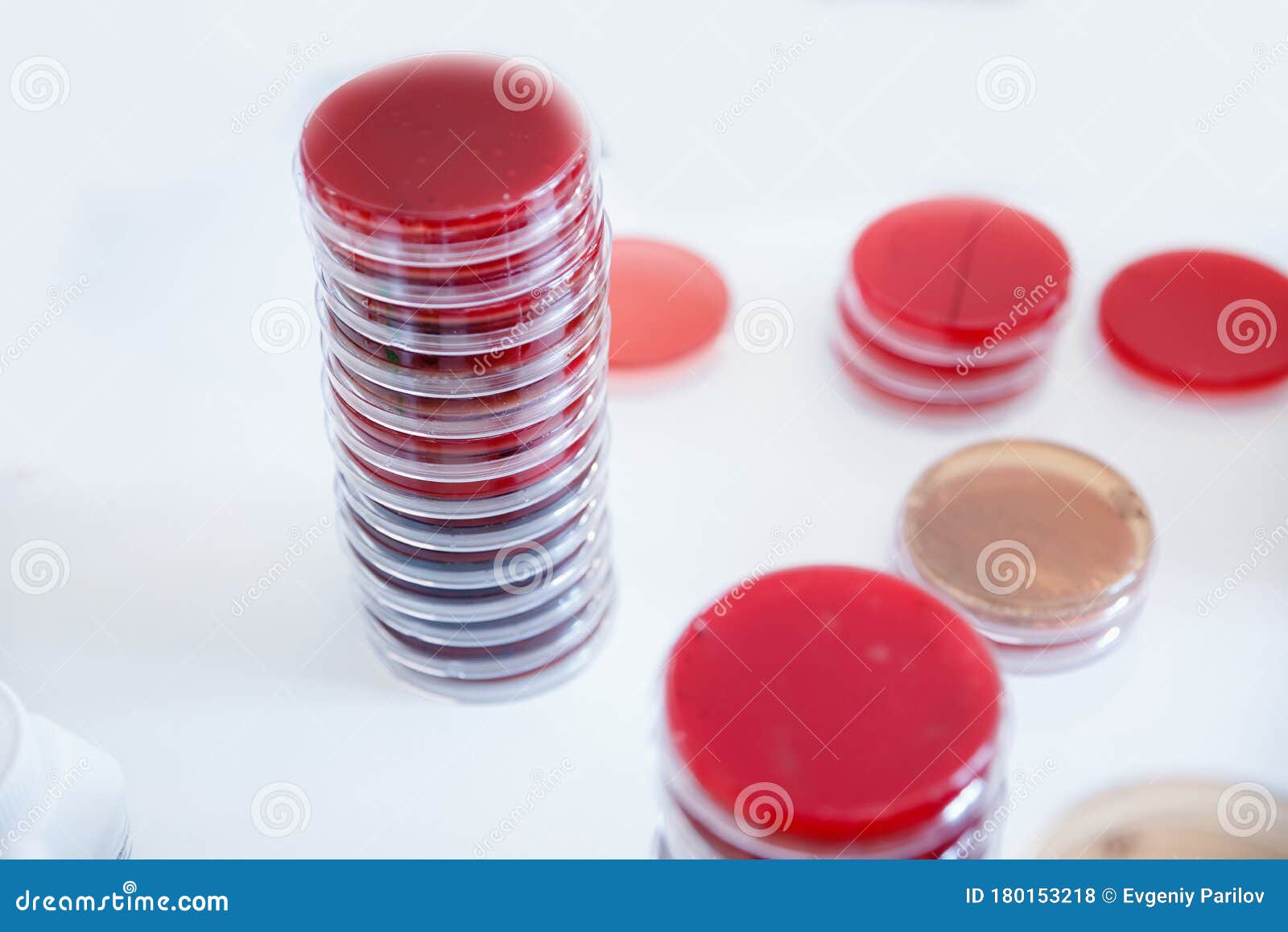 Microbiology Laboratory Agar Plate Full of Micro Bacterias and ...