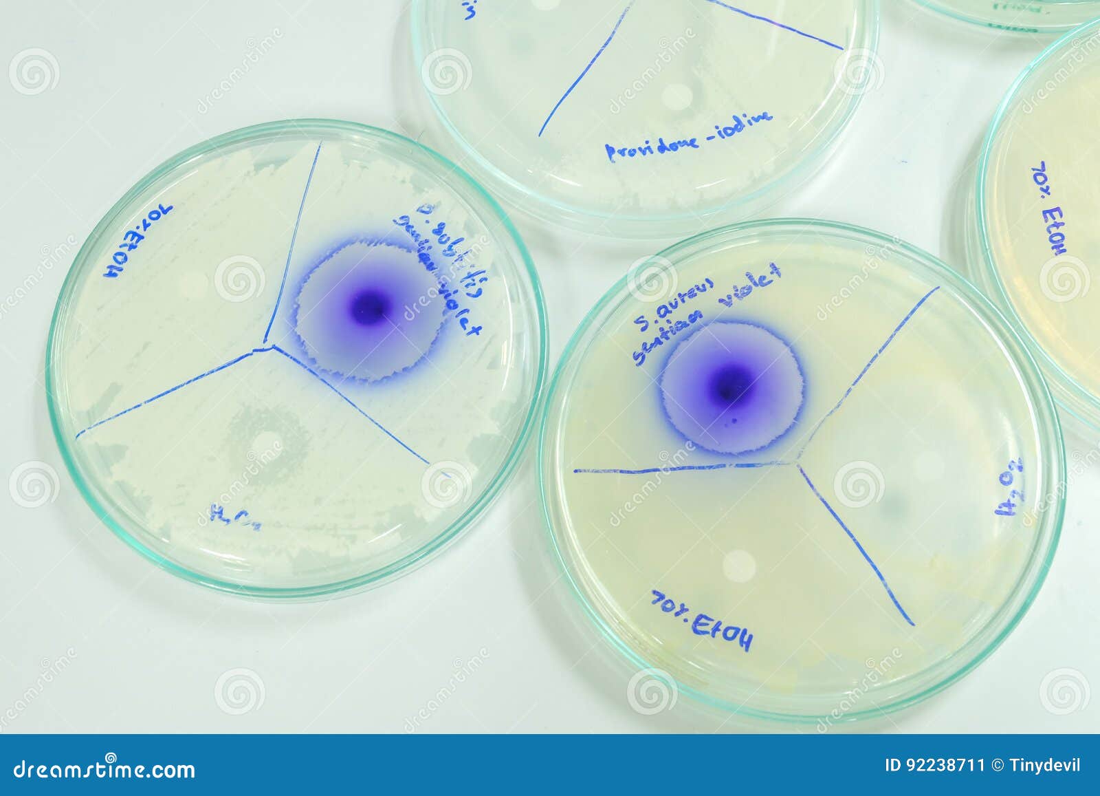 Microbiology Laboratory Test Stock Image - Image of growth, colony ...