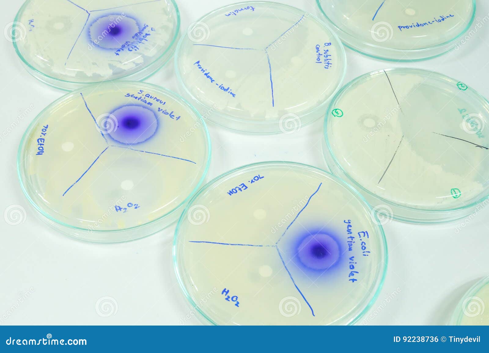 Microbiology Laboratory Test Stock Photo - Image of biotechnology, care ...