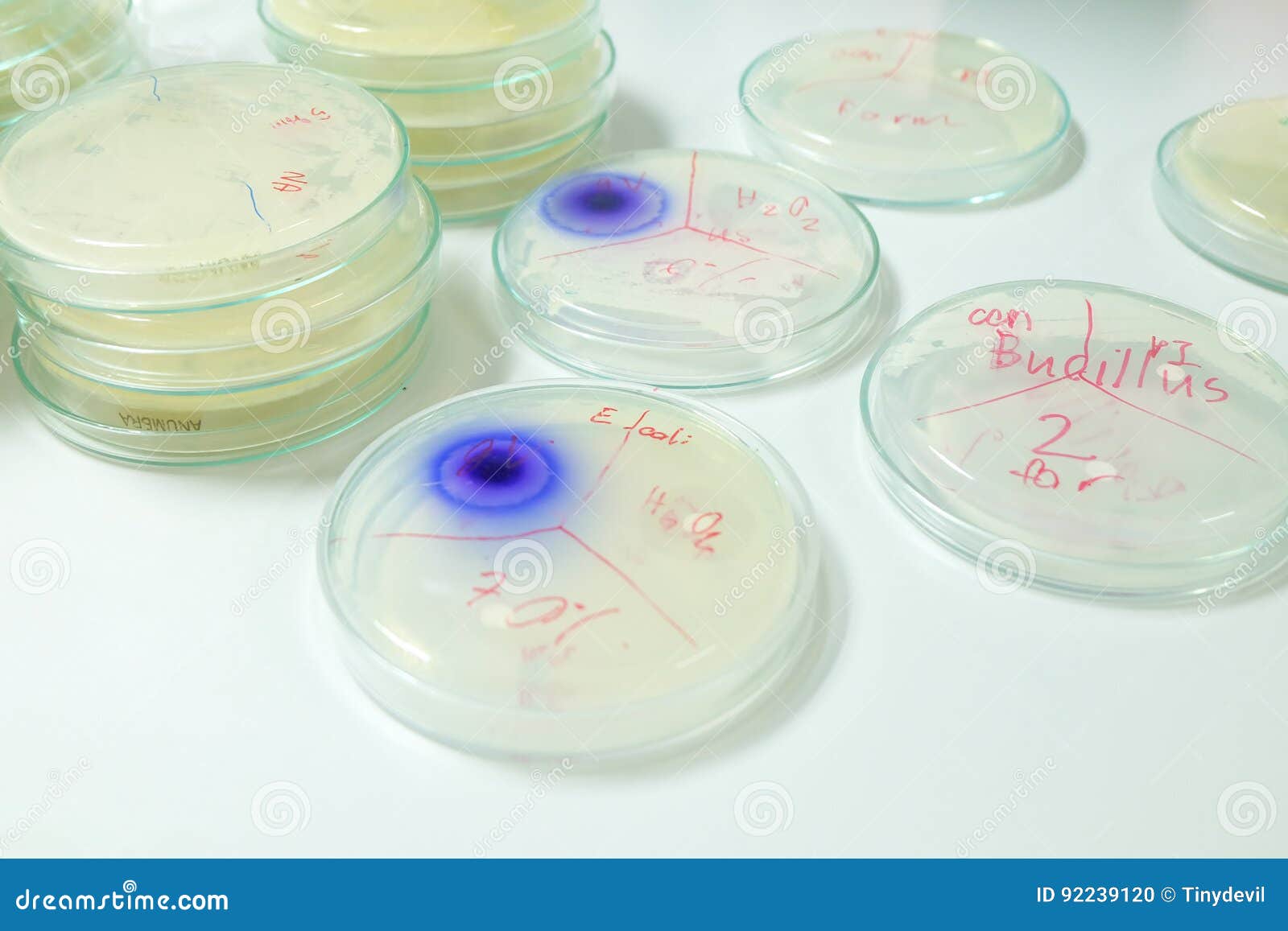 Microbiology Laboratory Test Stock Photo - Image of bacterial, growth ...