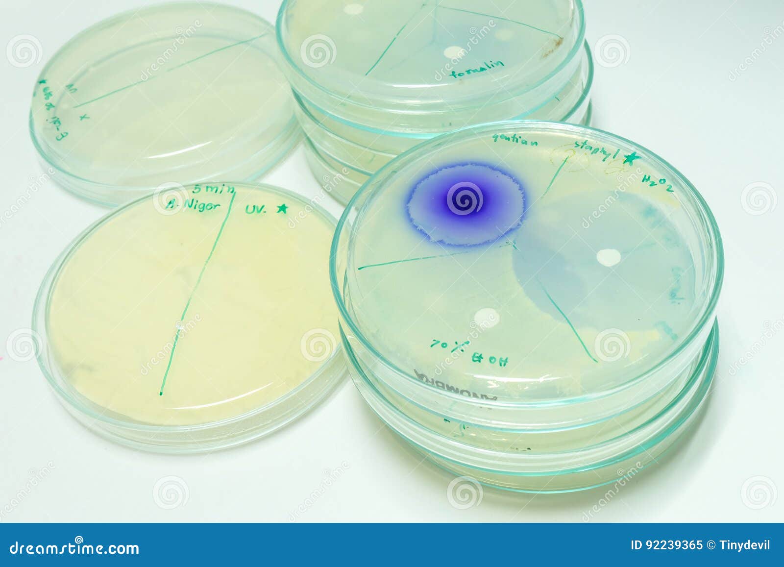 Microbiology Laboratory Test Stock Image - Image of grow ...