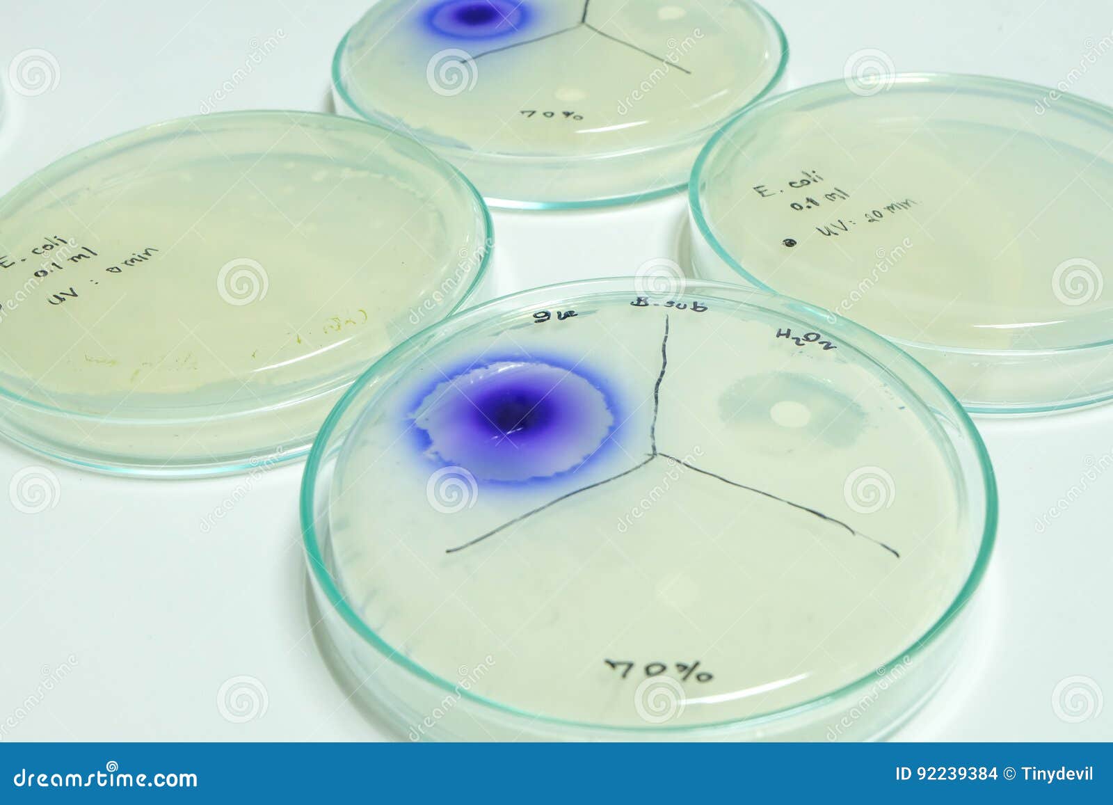 Microbiology Laboratory Test Stock Photo - Image of care, growth: 92239384