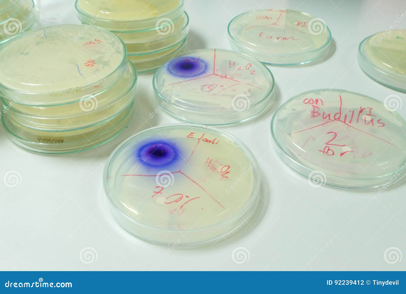 Microbiology Laboratory Test Stock Photo - Image of biology, bacteria ...