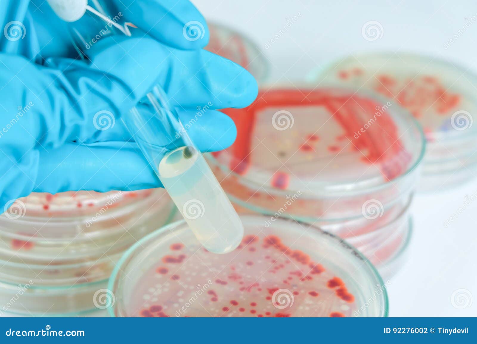 Microbiology Laboratory Test Stock Photo - Image of blue, penicillum ...