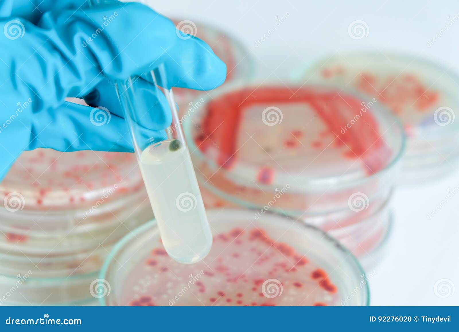 Microbiology Laboratory Test Stock Photo - Image of medical, organism ...