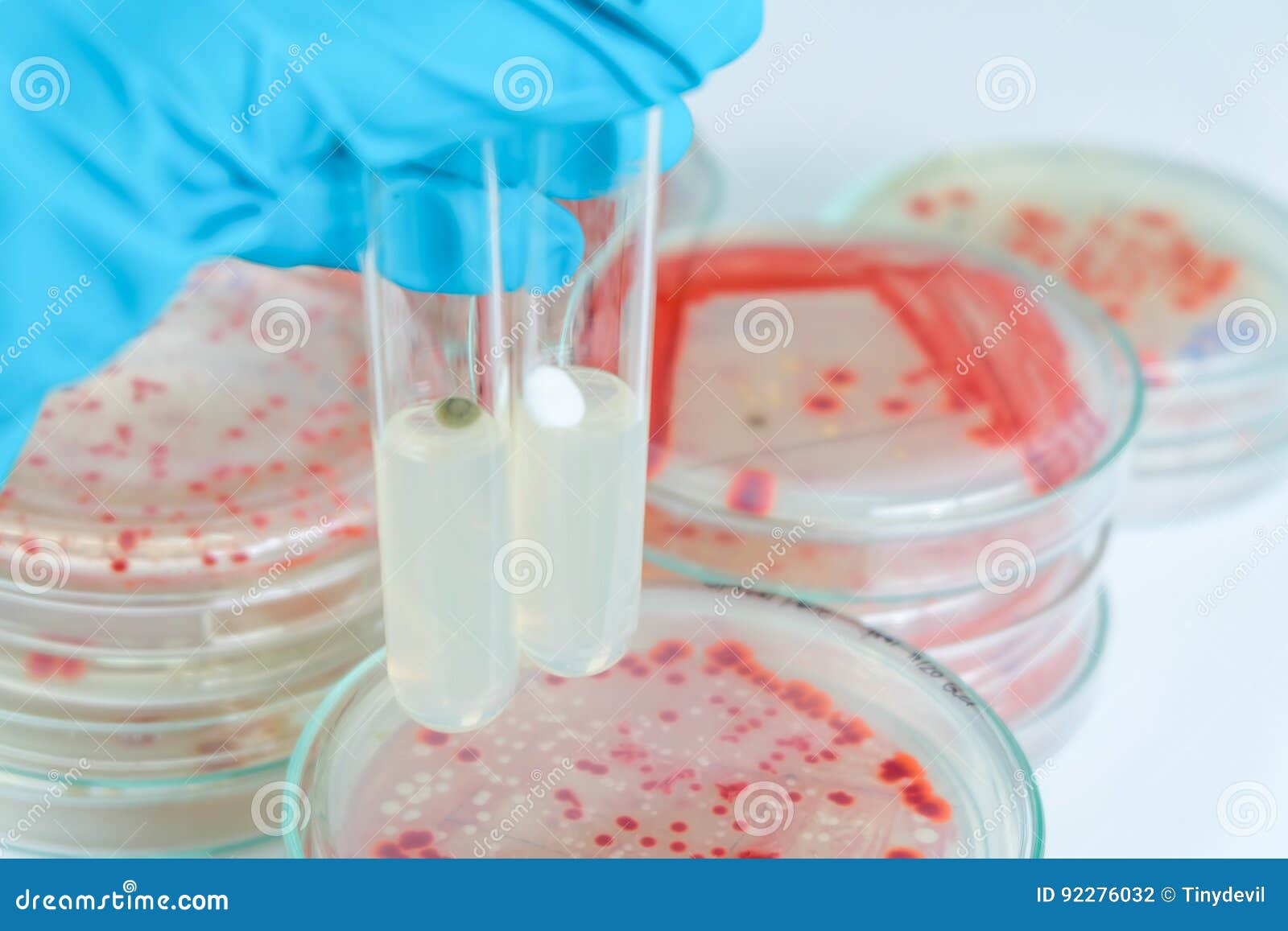 Microbiology Laboratory Test Stock Photo - Image of biotechnology ...