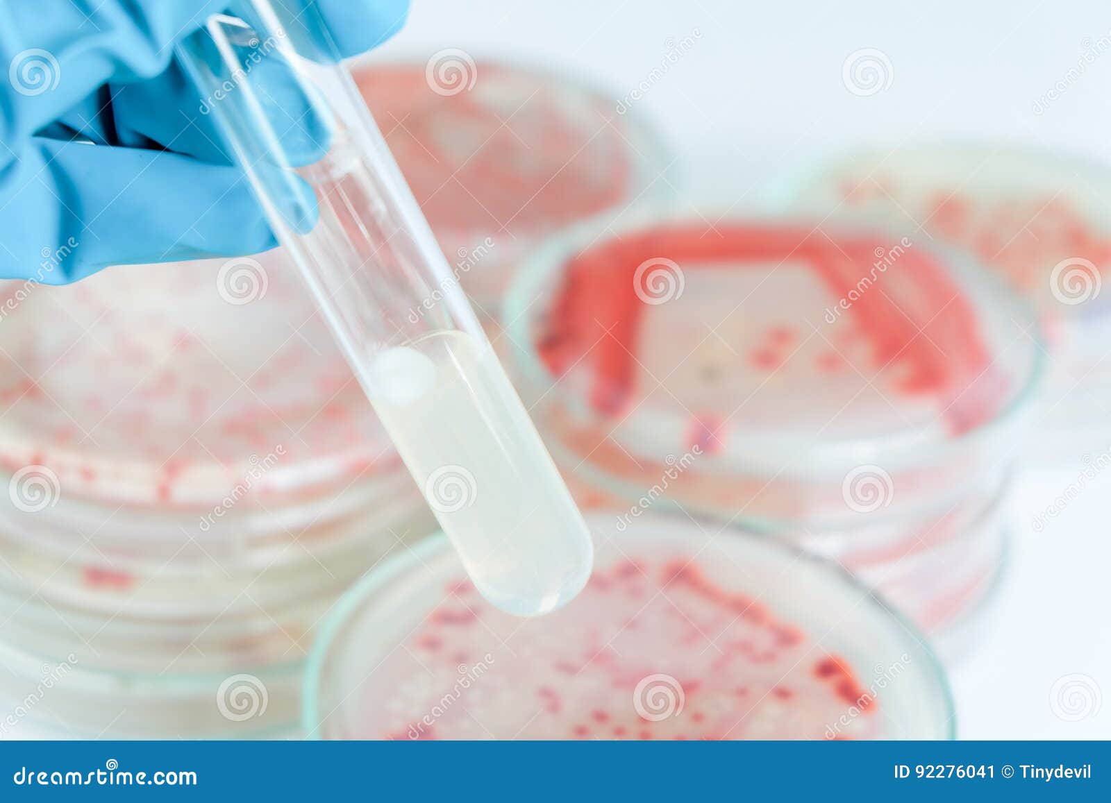 Microbiology Laboratory Test Stock Image - Image of investigation ...