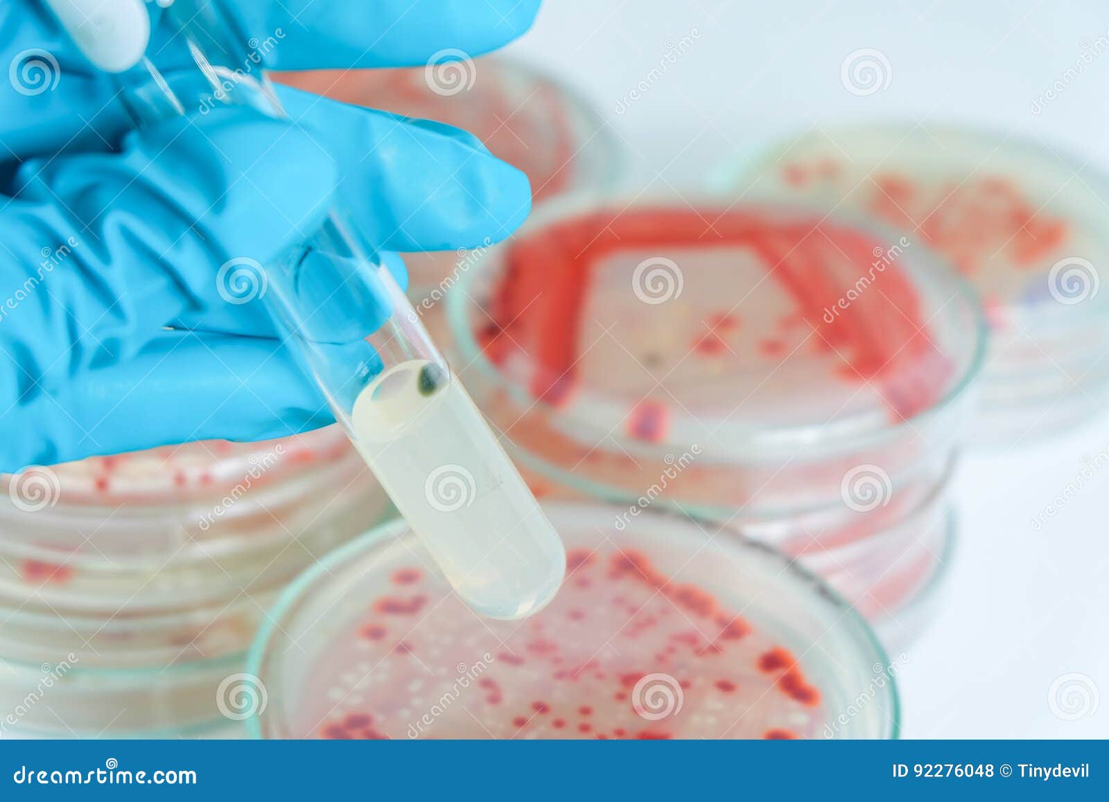 Microbiology Laboratory Test Stock Photo - Image of bacteria, molecular ...