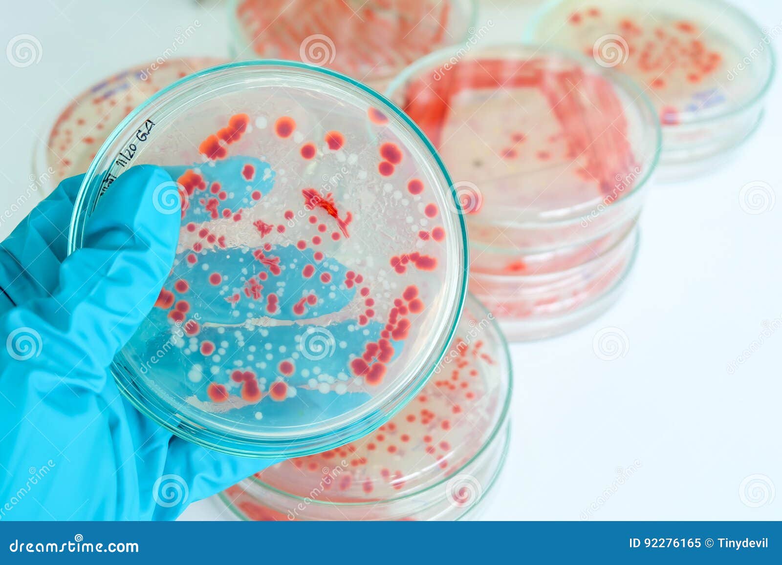 Microbiology Laboratory Test Stock Image - Image of grow, medicine ...