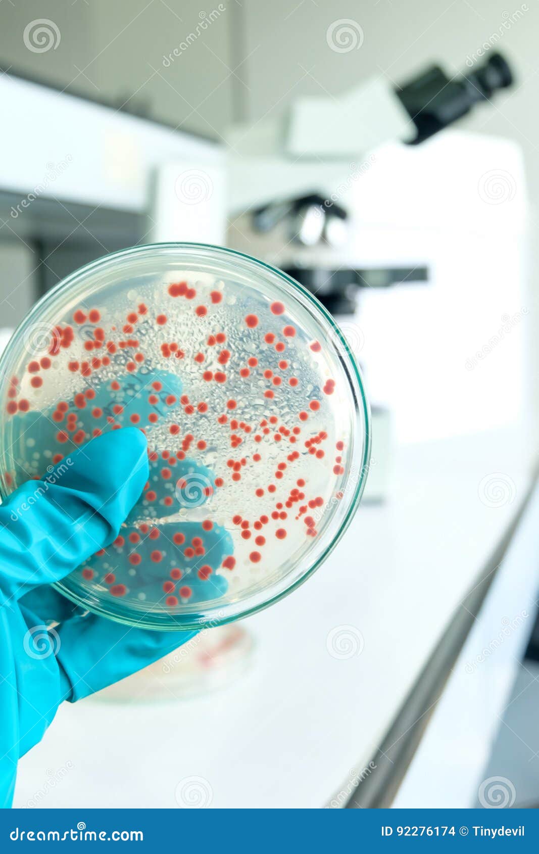 Microbiology Laboratory Test Stock Photo - Image of growth, colony ...