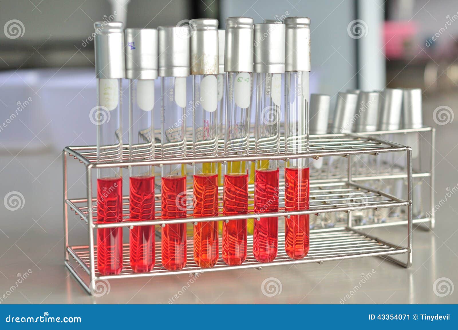 Microbiology Laboratory Test Stock Image - Image of laboratory ...