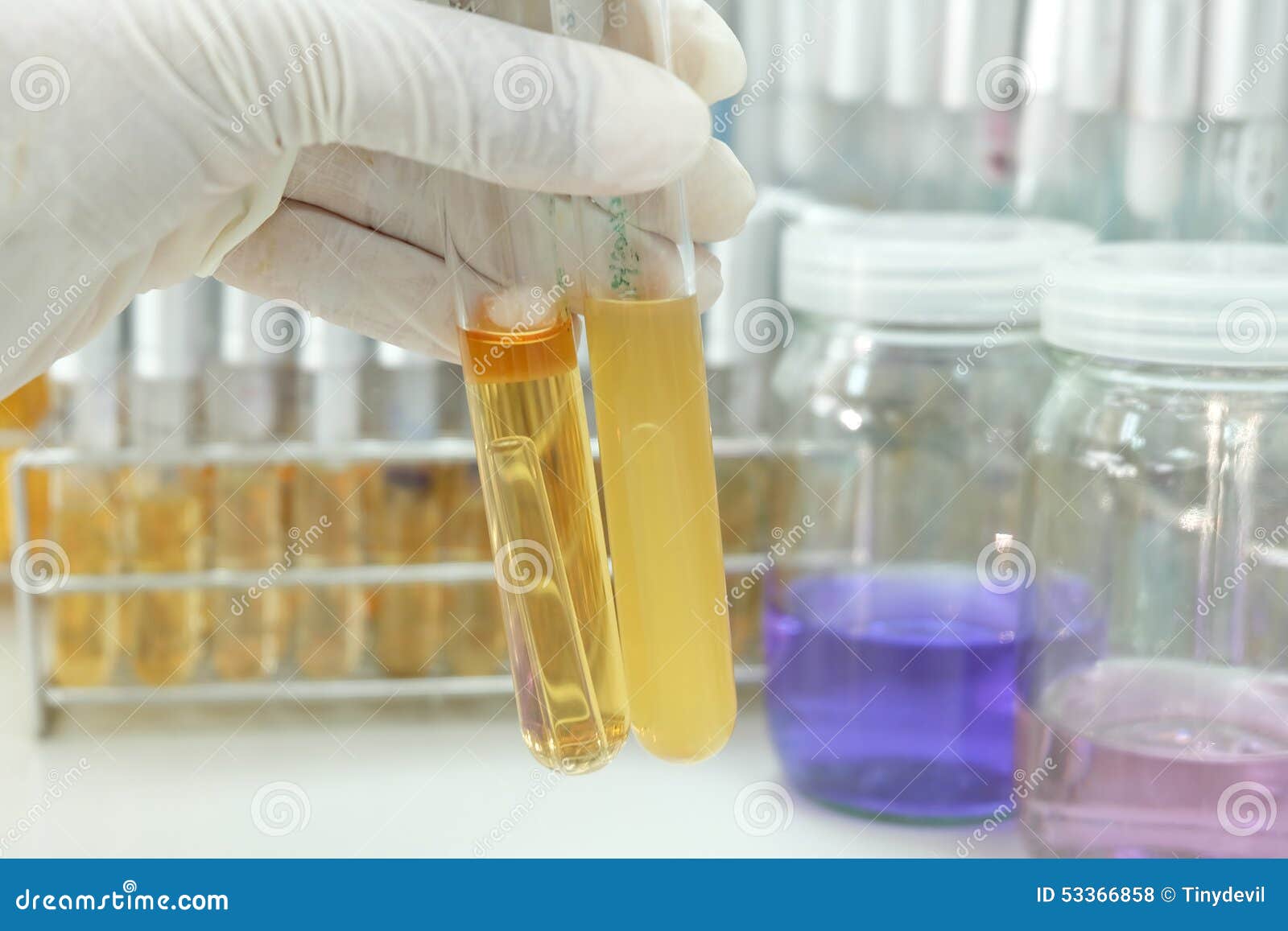 Microbiology Tool for Laboratory Test Stock Photo - Image of colony ...