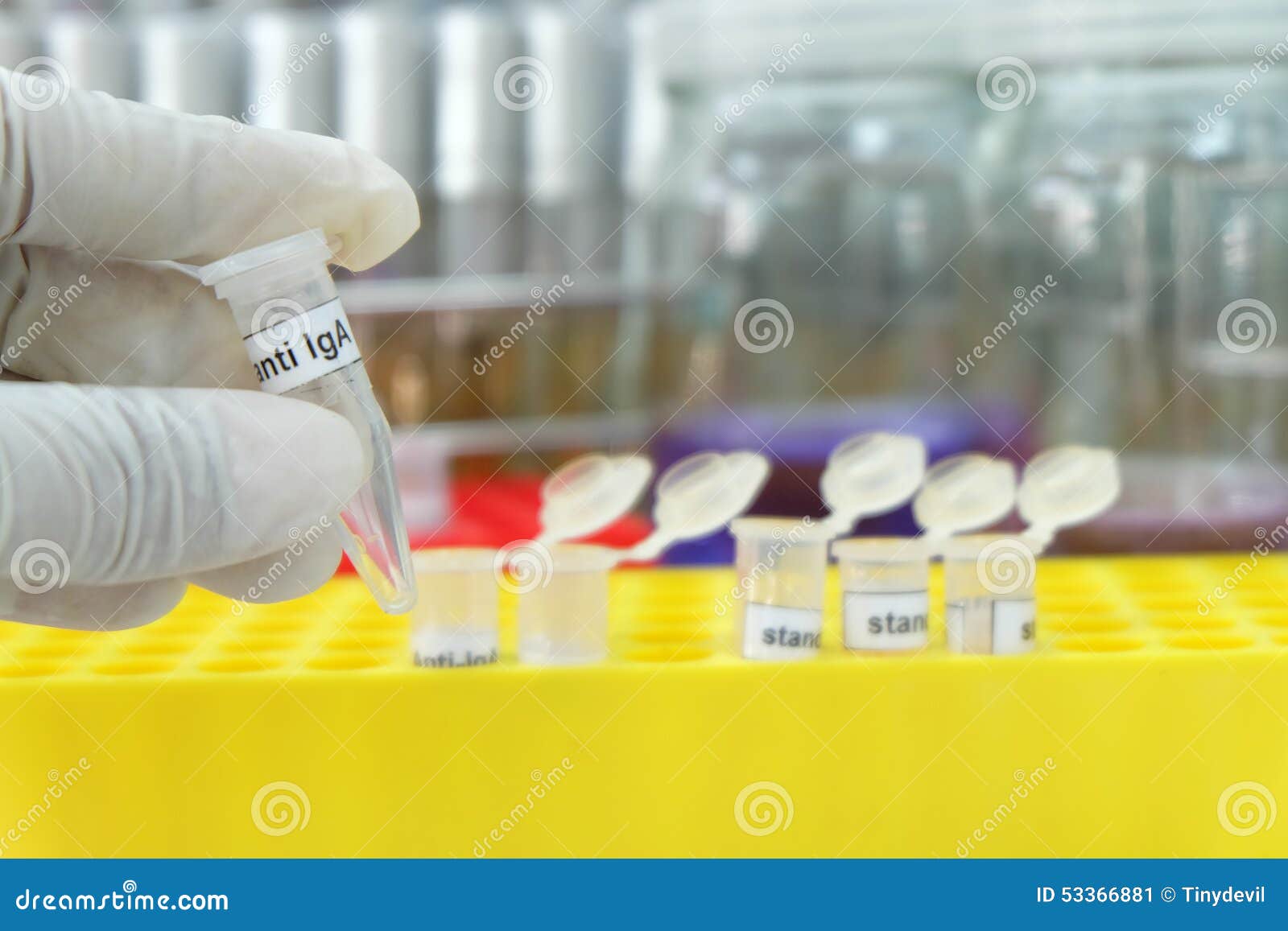 Microbiology Tool for Laboratory Test Stock Image - Image of culture ...