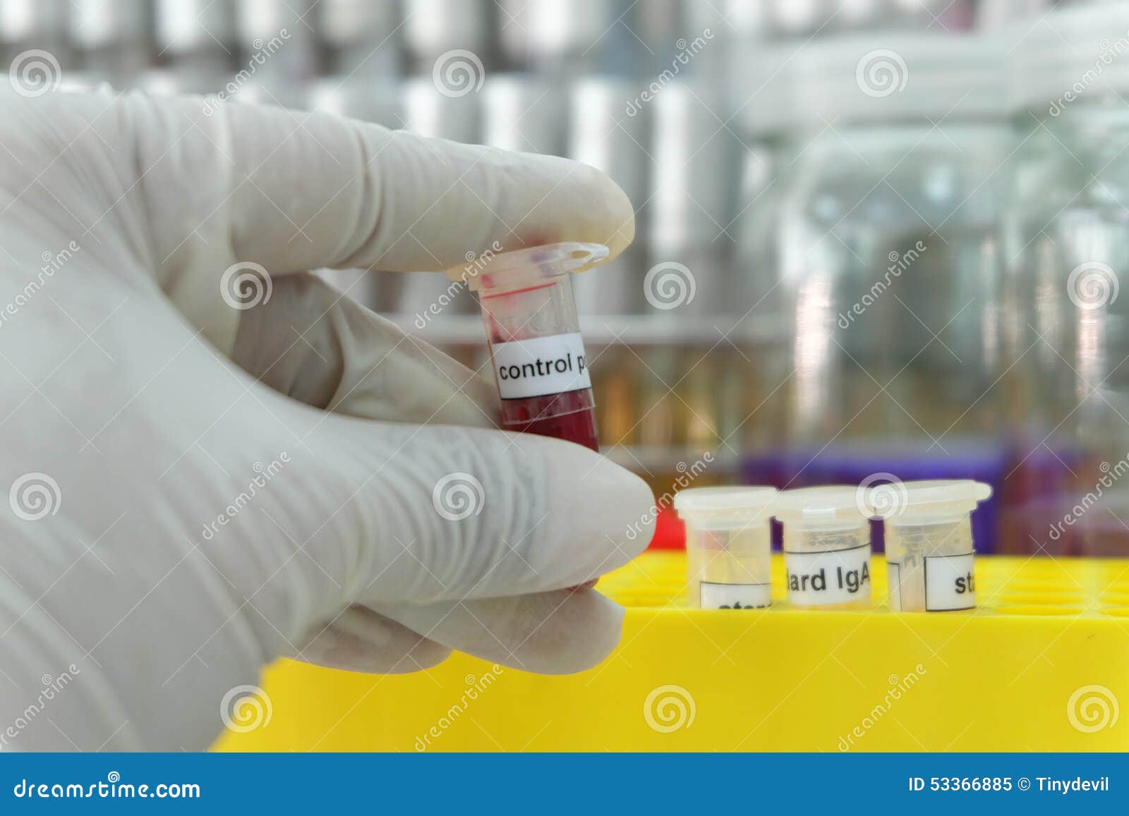 Microbiology Tool for Laboratory Test Stock Image - Image of biology ...