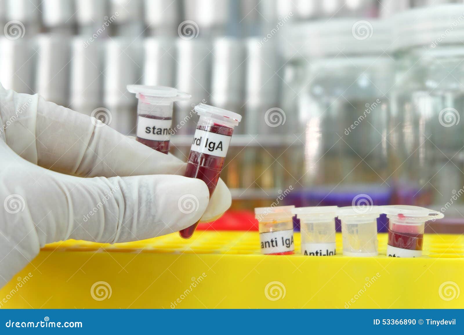 Microbiology Tool for Laboratory Test Stock Photo - Image of color ...
