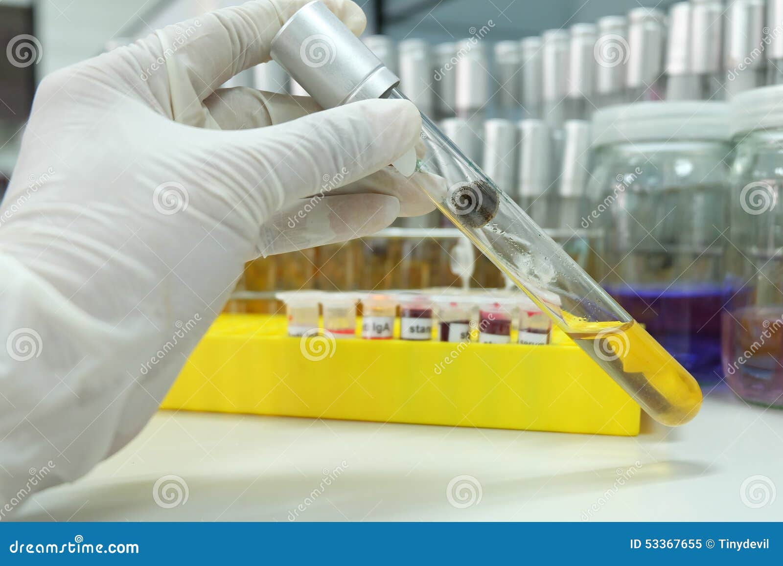 Microbiology Tool for Laboratory Test Stock Image - Image of ...
