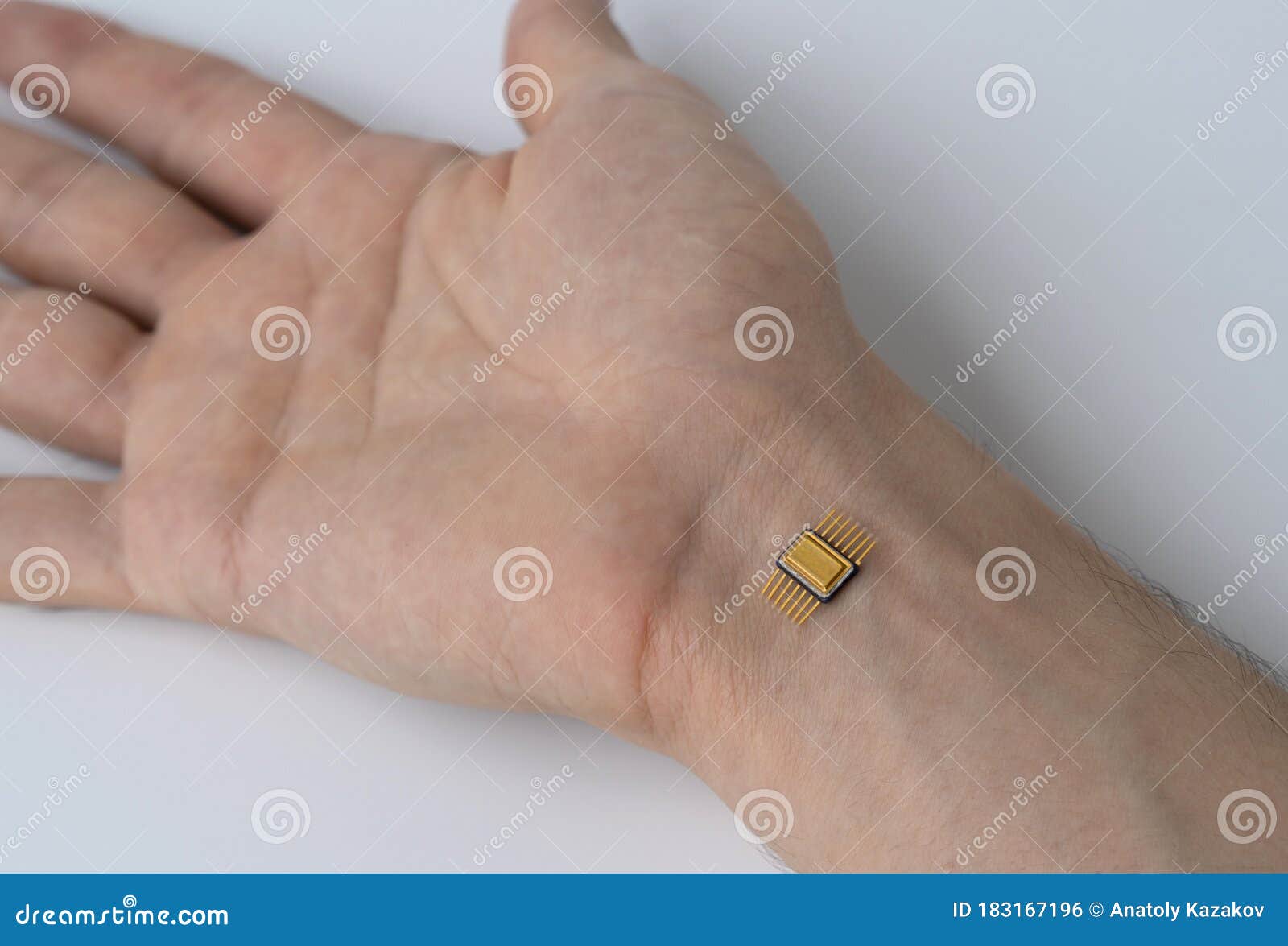 Microchip Is Connected To A Man Hand Implantation Of A Chip Under The