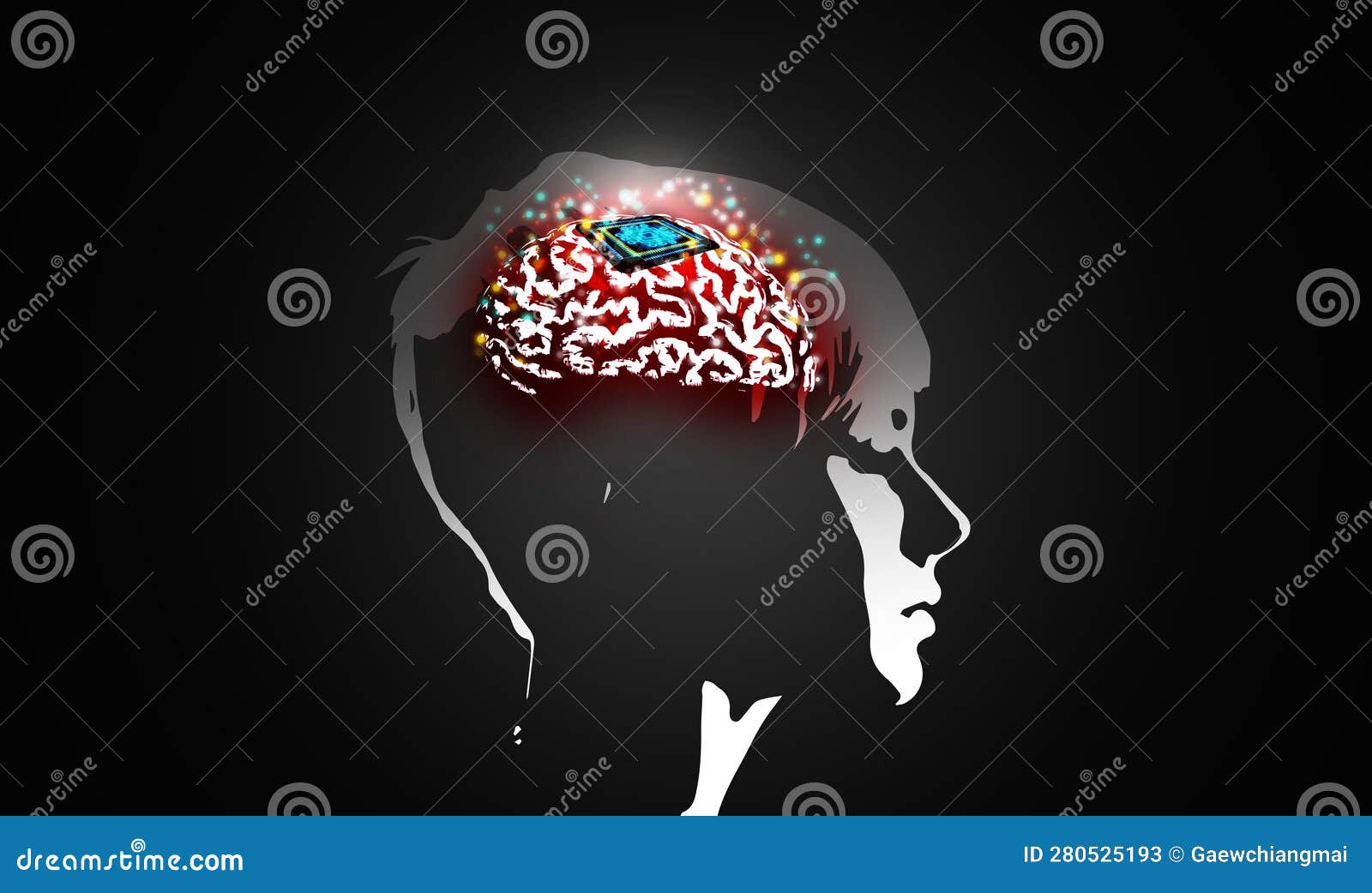 Microchip is Implanted in Human Brain. Neural Implants. Brain-computer ...