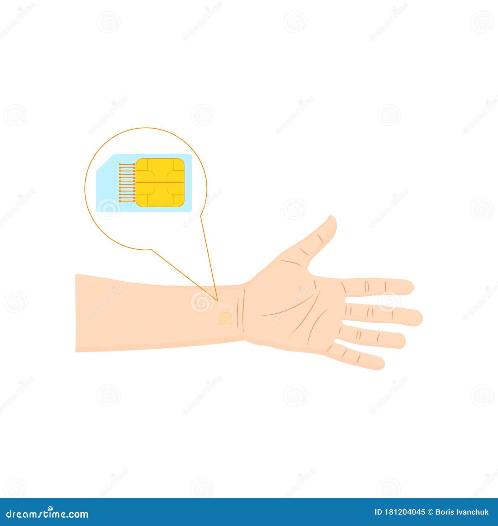 A Microchip Implanted Under the Skin in a Human Hand. Vector ...