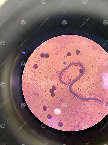 Microfilariae stock image. Image of disease, microscope - 273949377