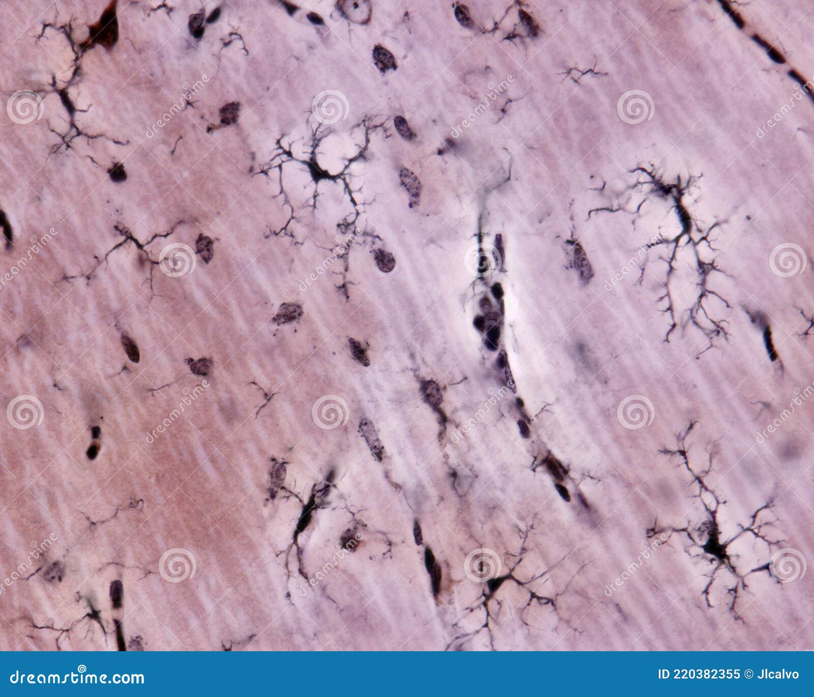 Microglia Royalty-Free Stock Image | CartoonDealer.com #220383250
